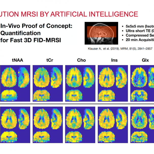 Clinical MR Imaging - CIBM | Center for Biomedical Imaging